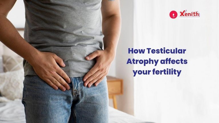 Male Infertility: How Testicular Atrophy affects your fertility