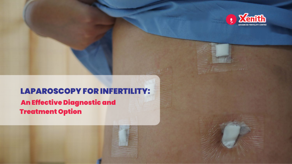Laparoscopy For Infertility An Effective Diagnostic And Treatment Option