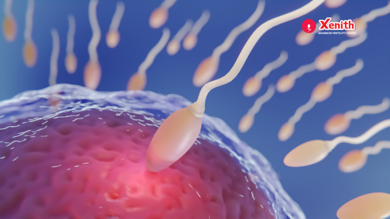 What are abnormalities in sperm? Explained by Xenith