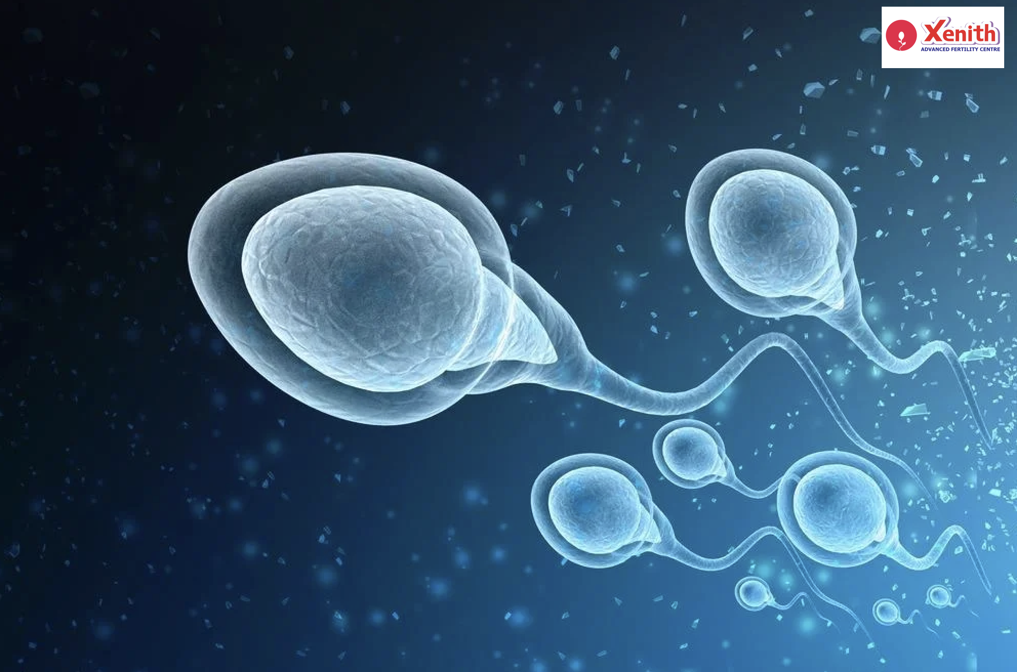 Sperm Sorting Techniques | Xenith Advanced Fertility Center in Pune