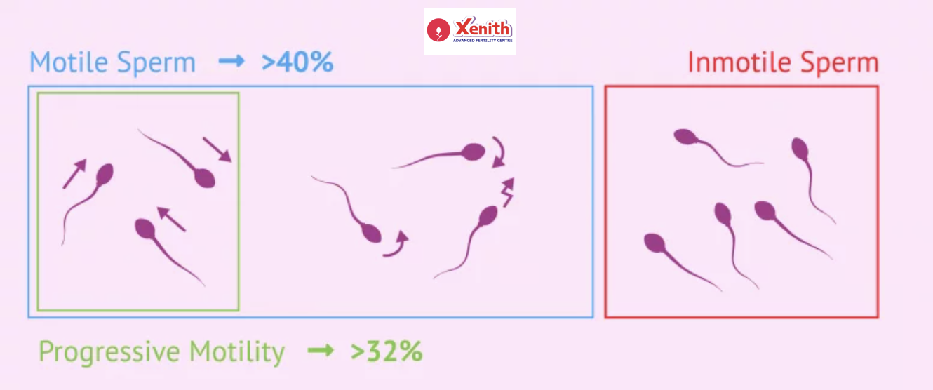 Low Sperm Motility (Asthenozoospermia): Causes, Symptoms, and Treatment ...